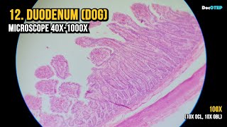 Duodenum Slide Labeled