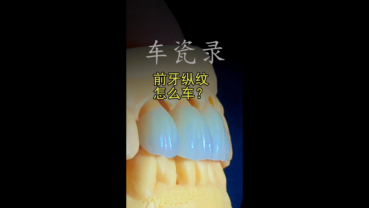 Repair of longitudinal grooves on anterior teeth - YouTube