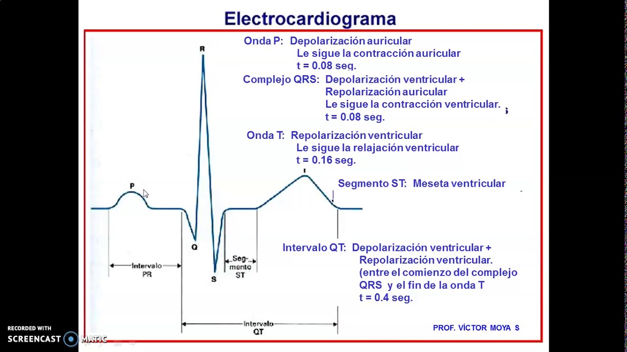 Clases Sistema Excito conductor parte IV - YouTube