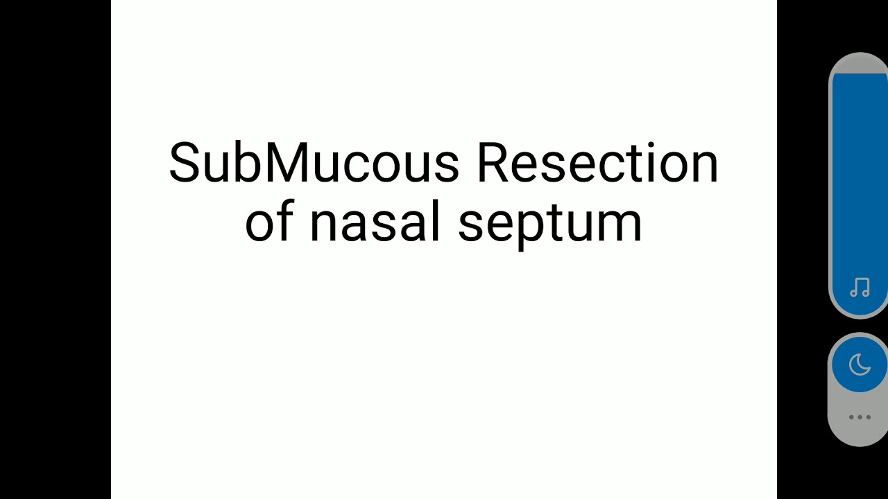 Sub mucous resection procedure lecture part 1 - YouTube