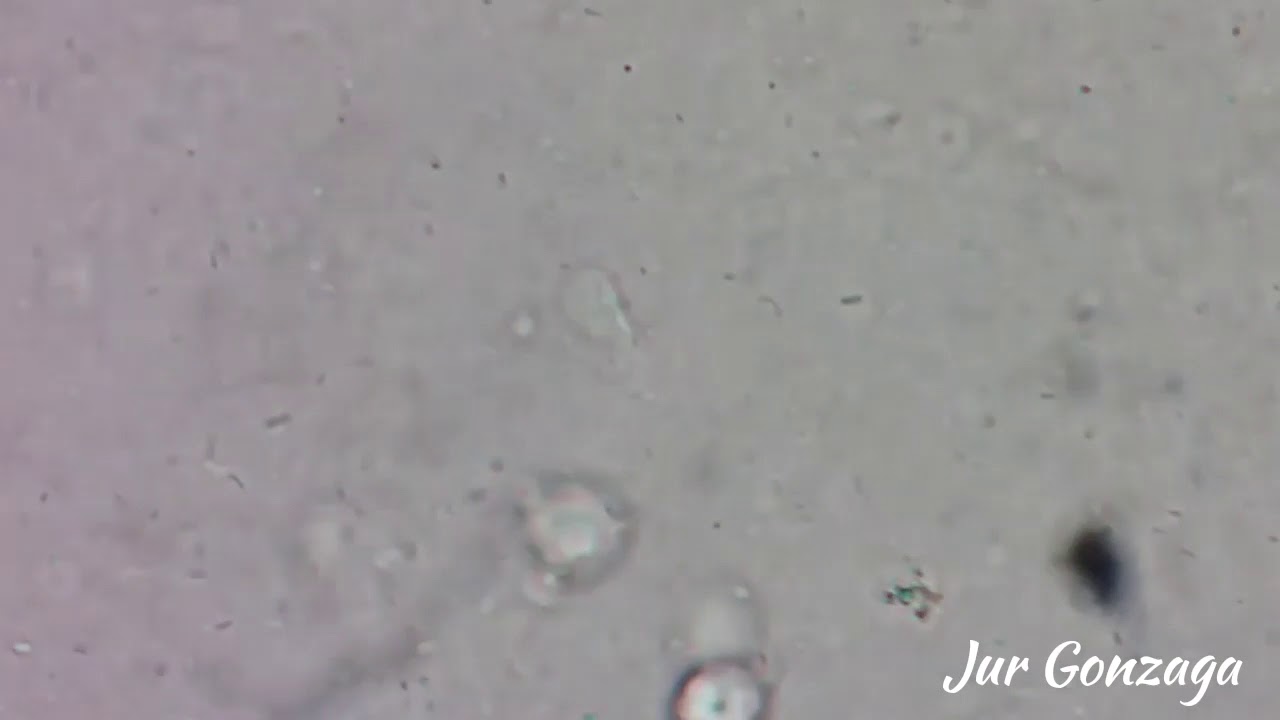 Giardia lamblia (intestinalis) trophozoite - YouTube