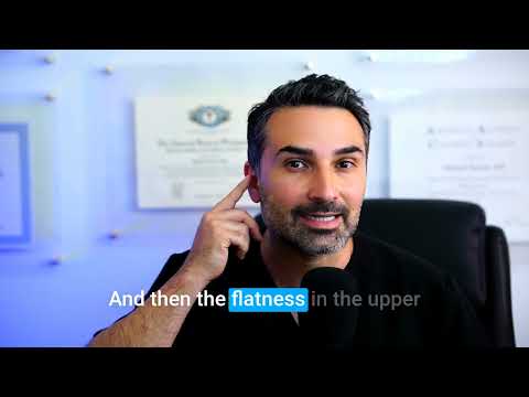 Otoplasty covered by facial plastic surgery expert, Masoud Saman, MD