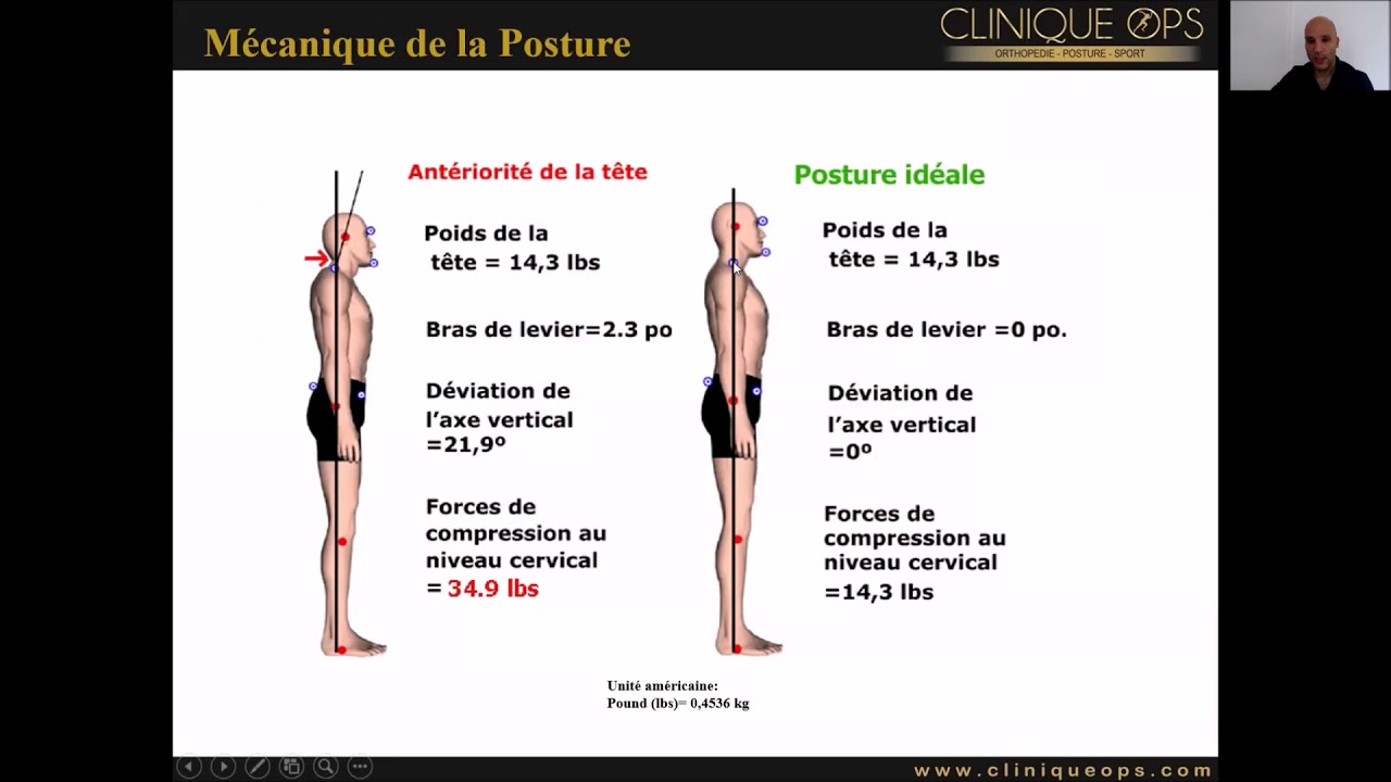 Partie 1.5 : Vision du déficit postural en Orthokinésie - YouTube