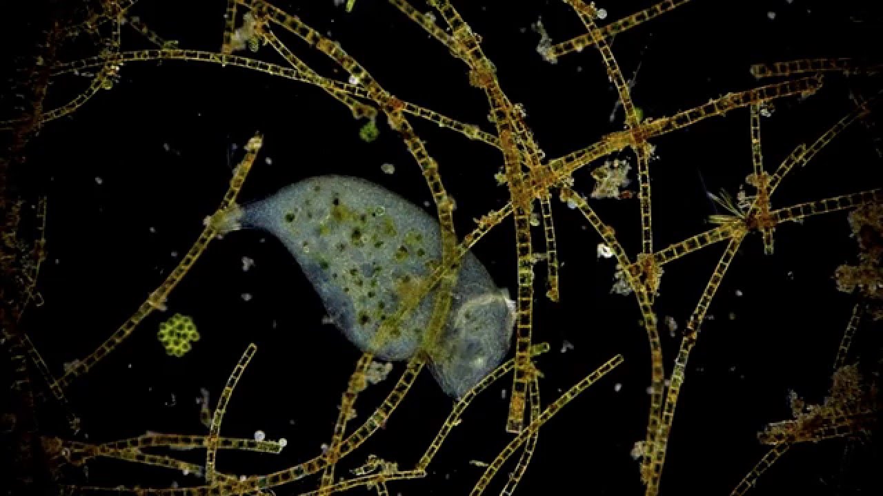 🔬 Mikroorganismus - microcosmos - microorganism in dark field ...