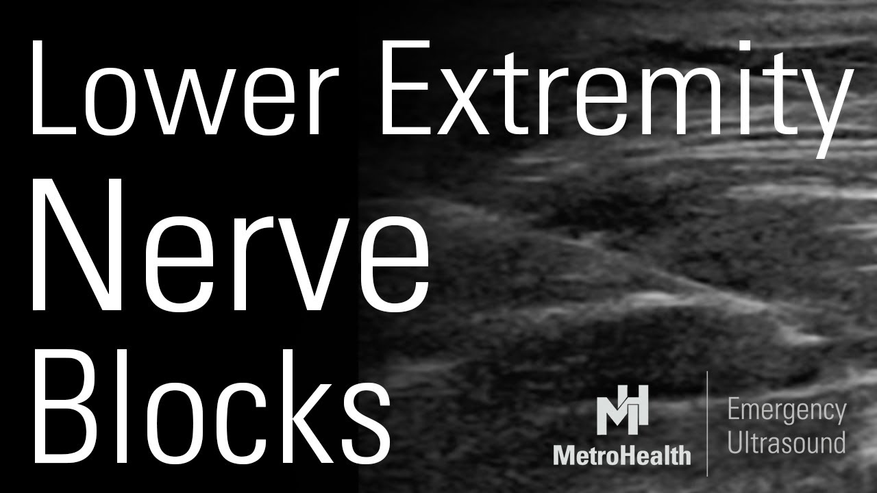 Ultrasound Guided Lower Extremity Nerve Blocks - YouTube