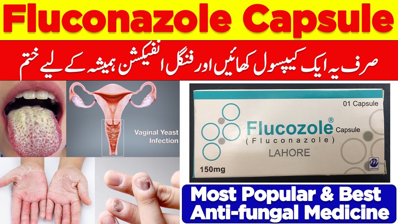 Fluconazole | Capsule Fluconazole 150mg | Uses Of Fluconazole Tablet ...