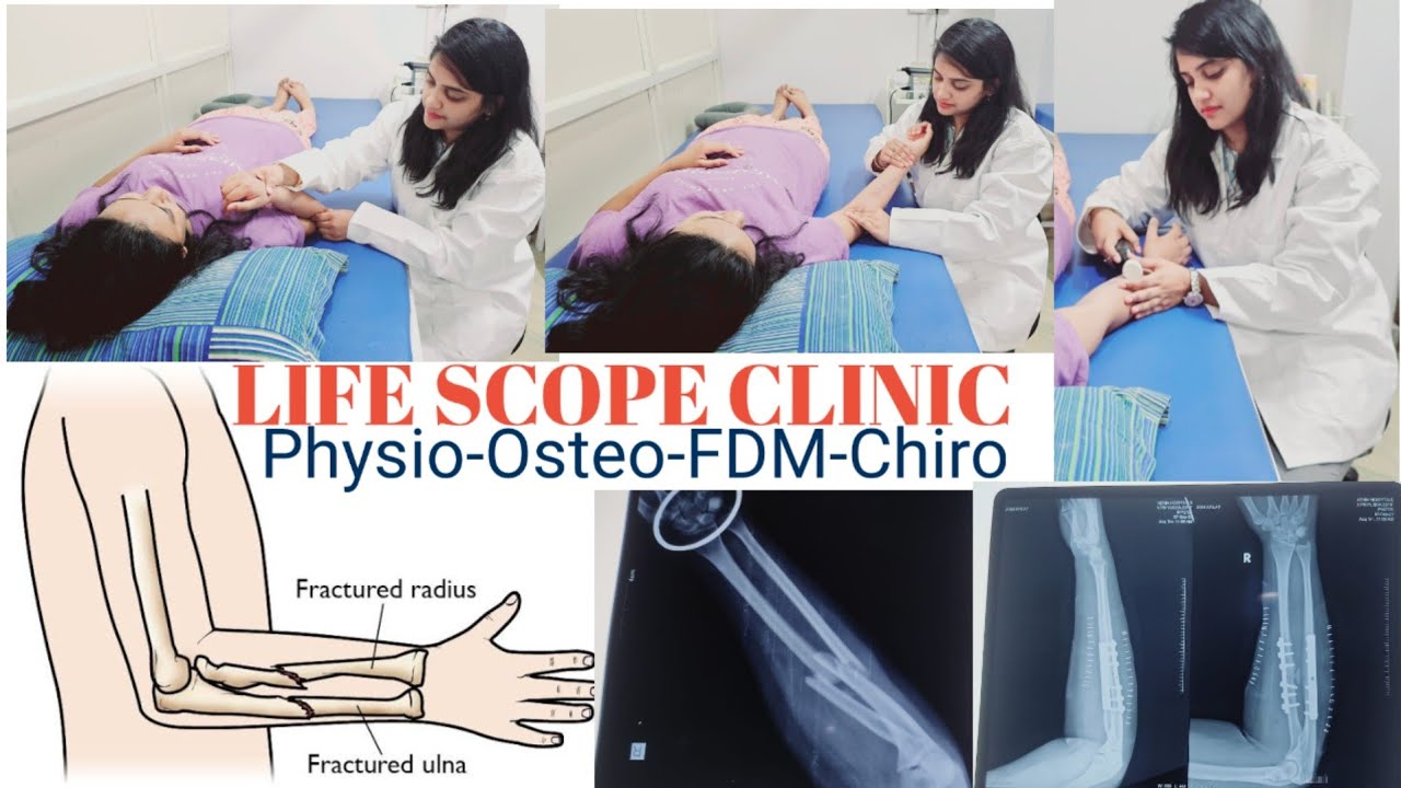 Post Operative Both Bone Fracture Improvement with Advanced ...