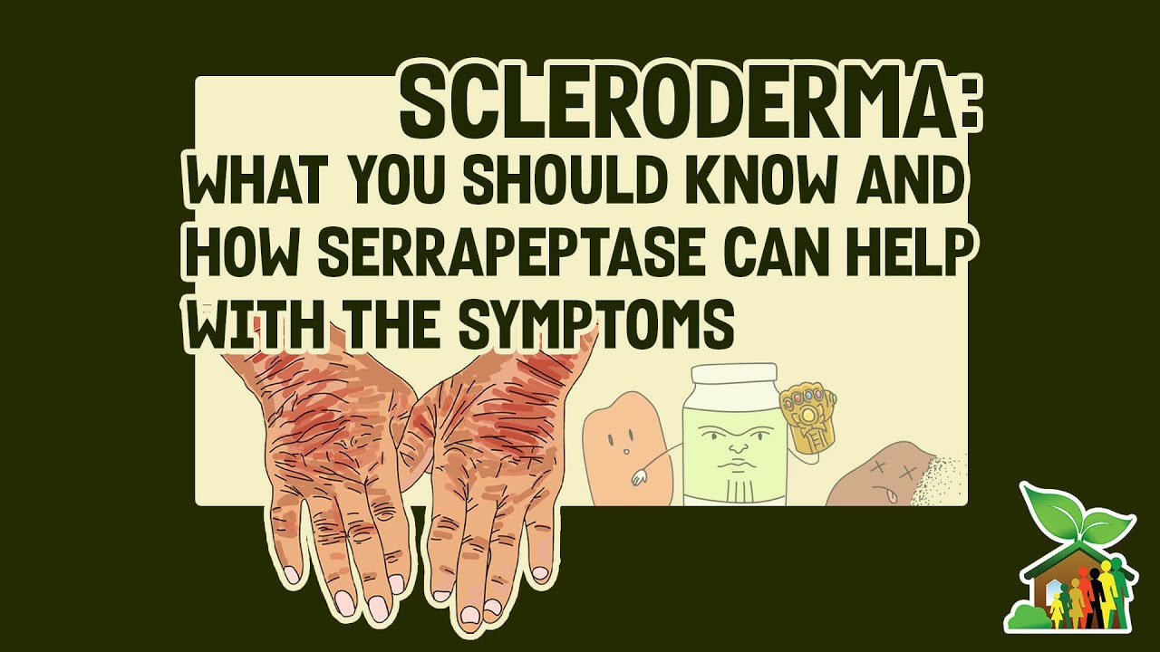 Scleroderma: What You Should Know and How Serrapeptase Can Help with ...