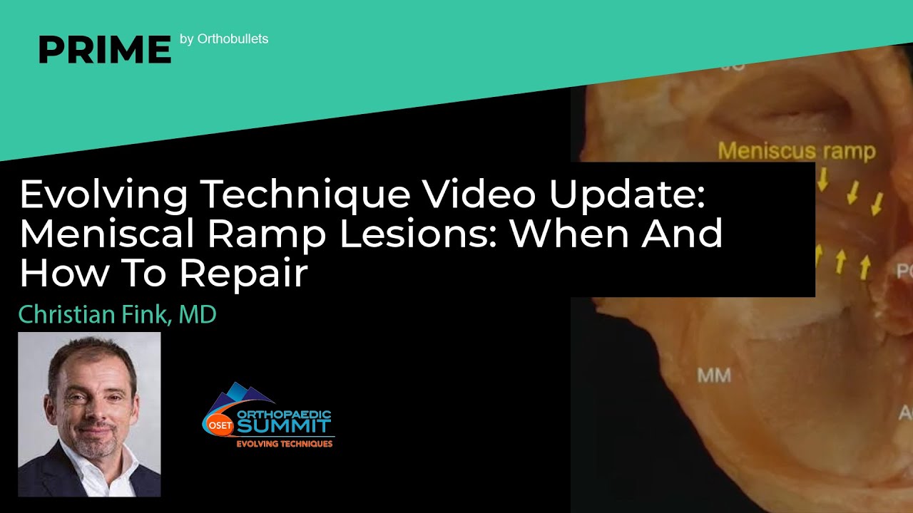 Evolving Technique Video Update: Meniscal Ramp Lesions: When And How To ...