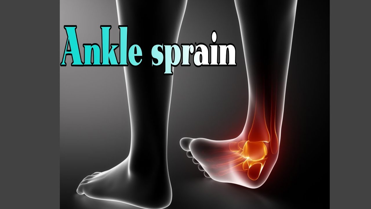 Tapilok o Ankle Sprain Part 1 | House Physiotherapy - YouTube