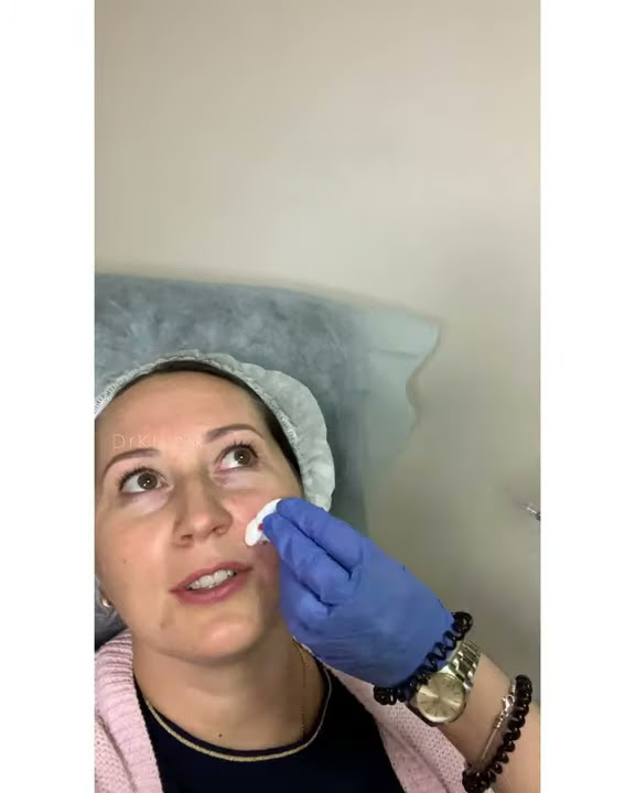 Липолитики для лица👩🏻‍⚕️ - YouTube