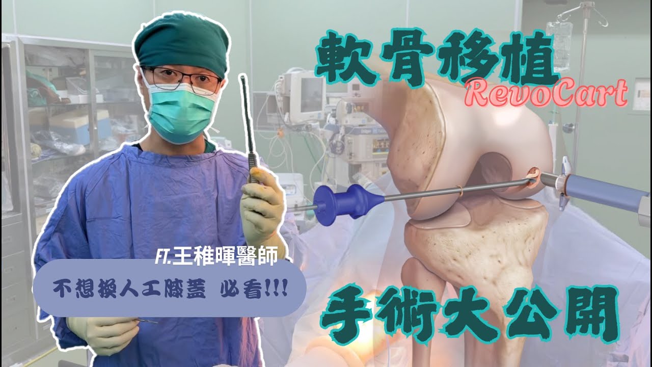 自體軟骨移植術｜RevoCart｜ft.王稚暉醫師 - YouTube