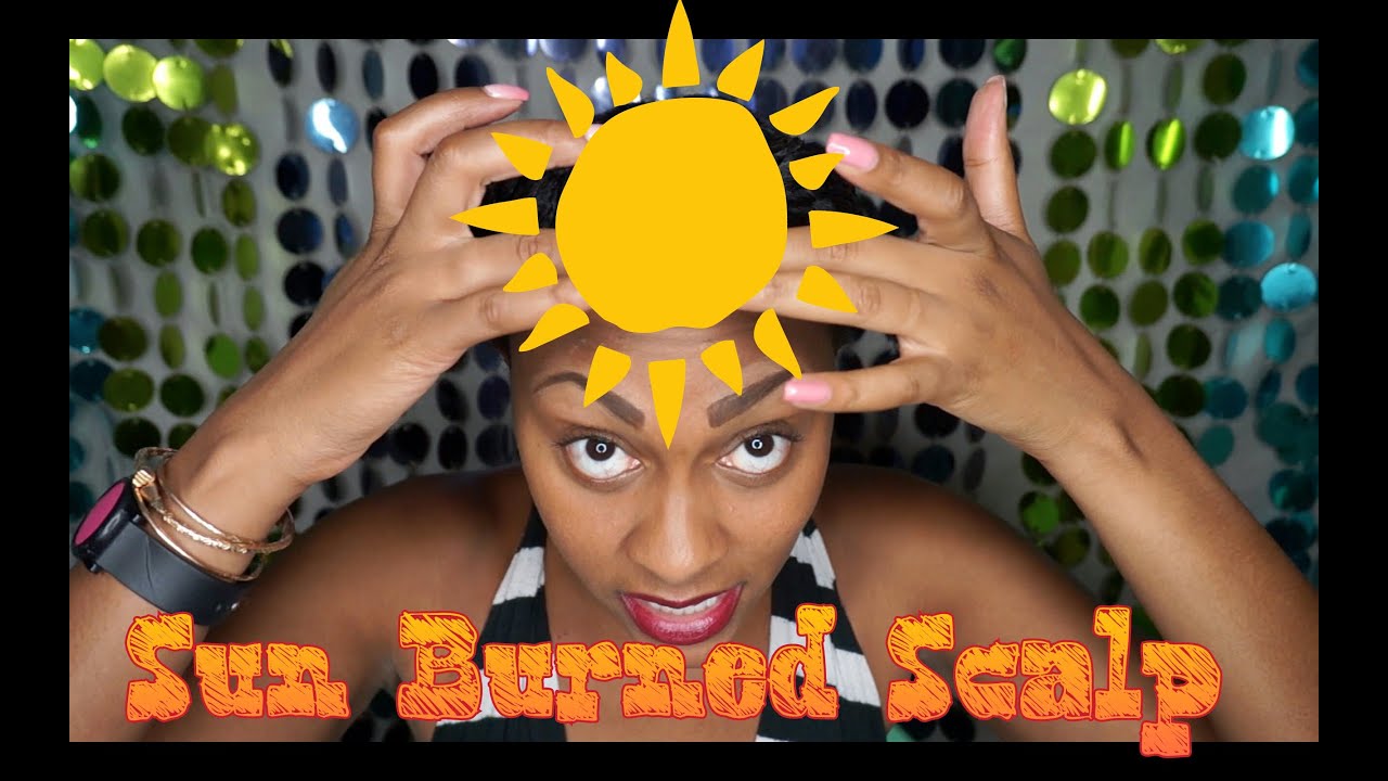 How To Avoid A Sunburned Scalp Youtube
