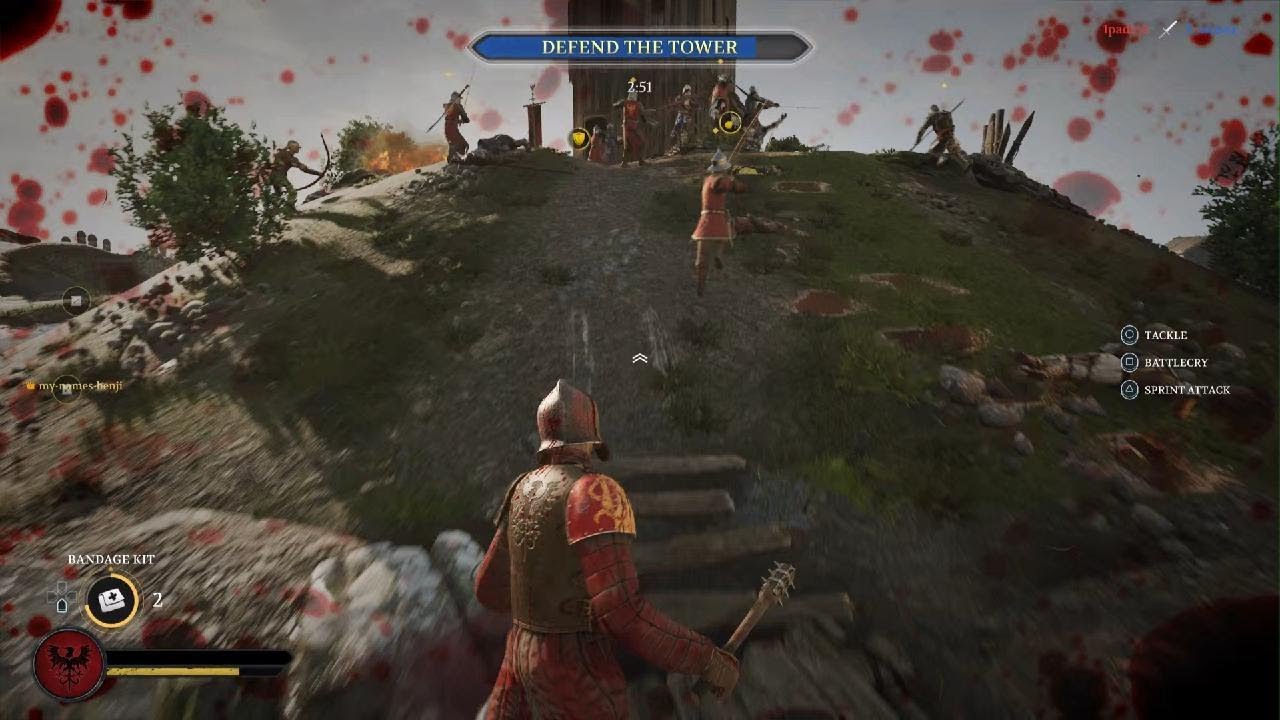 Chivalry 2 - the 5v1 was real - YouTube