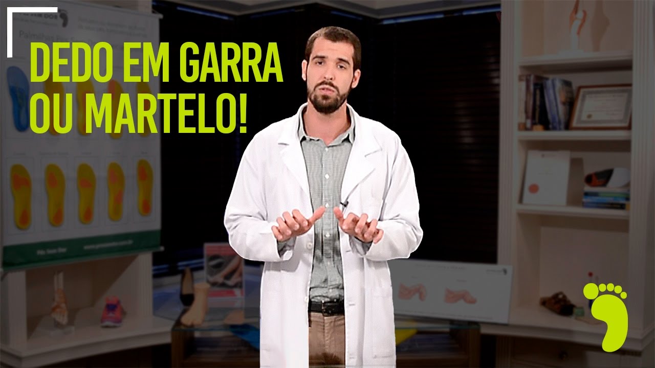DEDOS EM GARRA OU EM MARTELO: o que fazer? | Pés Sem Dor 👞 - YouTube