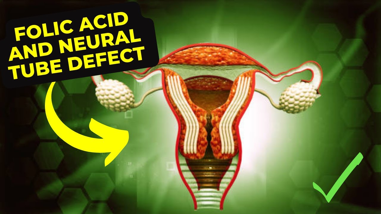 Folic Acid and Neural Tube Defect Prevention in Pregnancy - YouTube