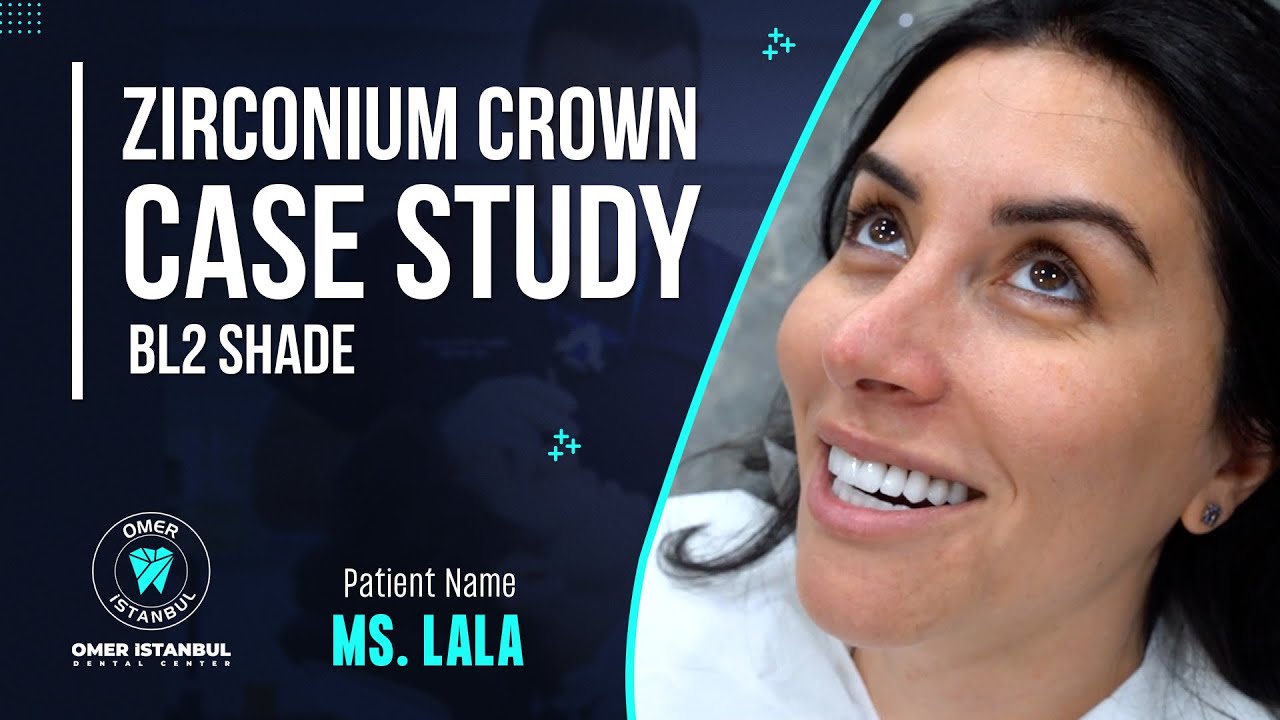 Gum + Zirconia Teeth Treatment Case Study (BL2 Shade) - Narrated by Dr ...