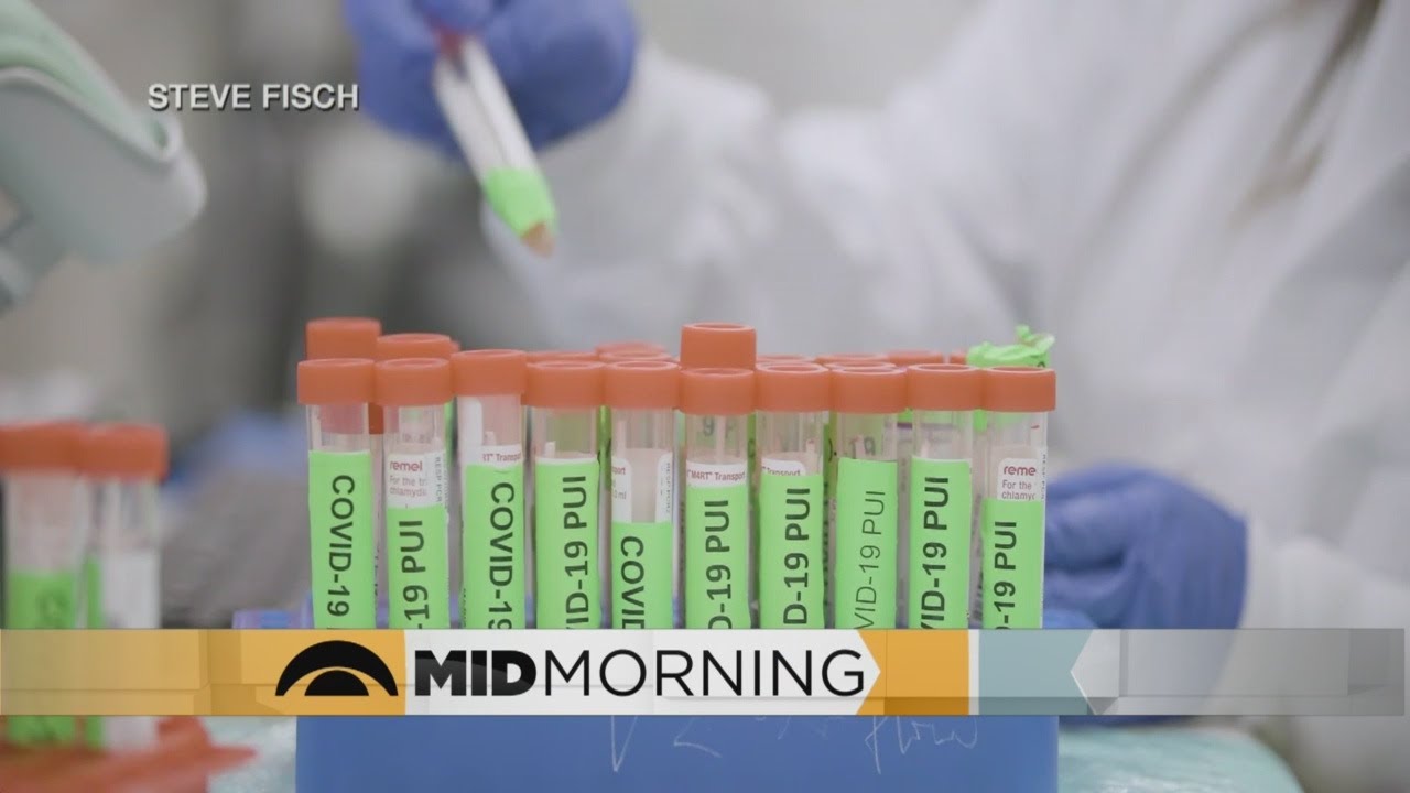 Are Test Results Now Delayed More Than Usual? - YouTube