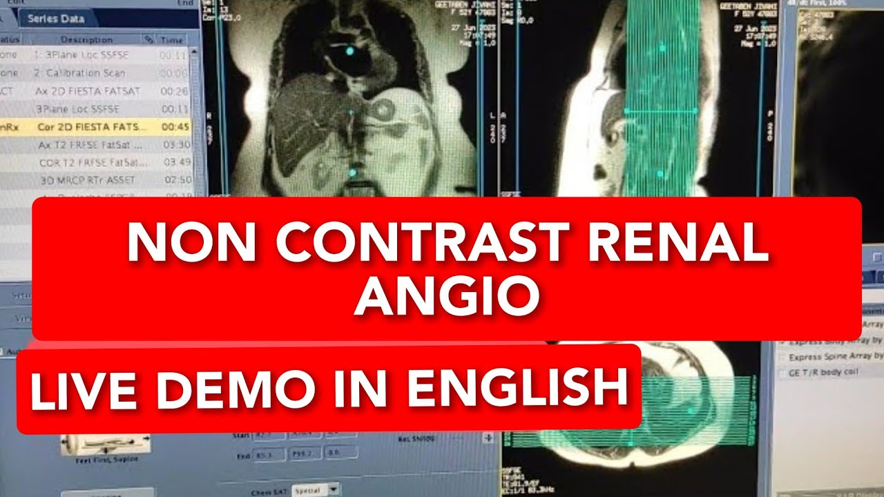 MRI Renal Angiography protocol, positioning and planning | Live Demo in ...