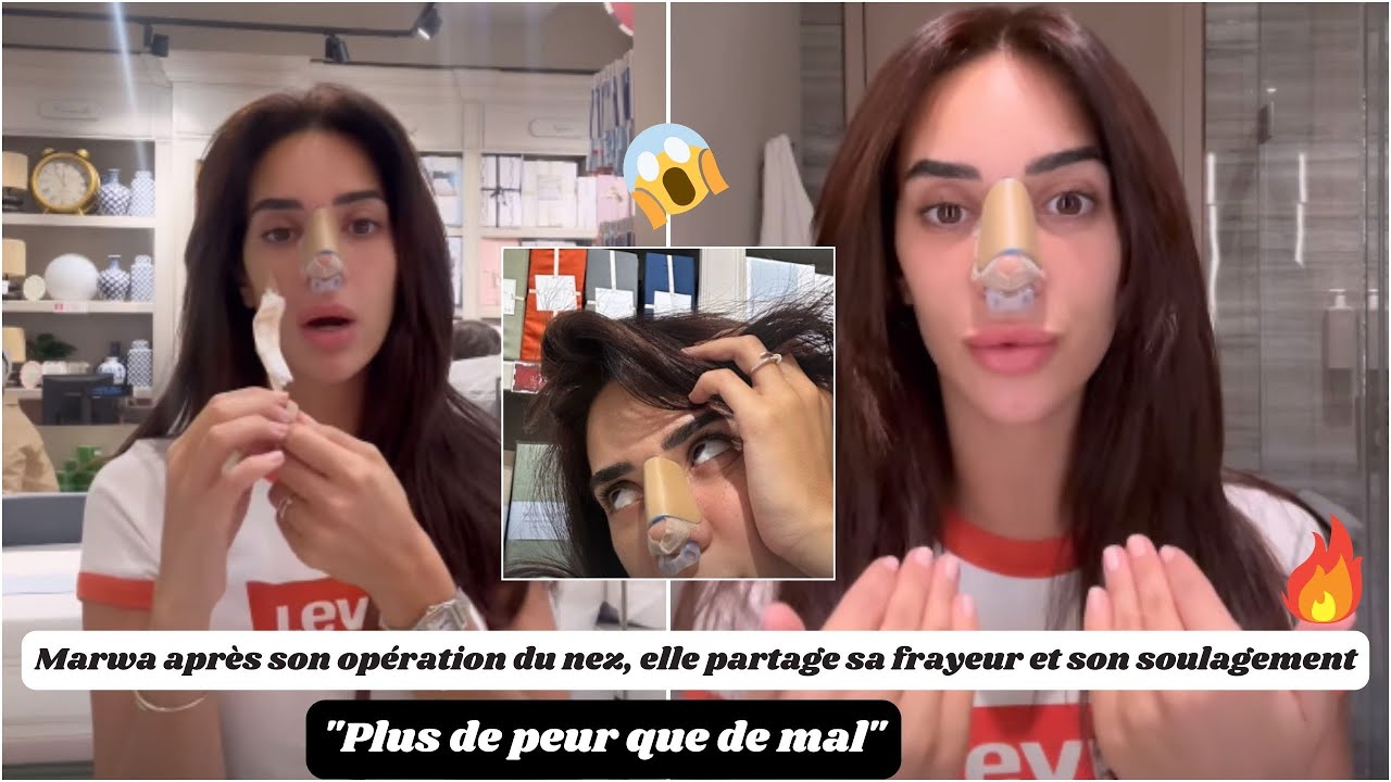 Marwa (La Villa) : après son opération du nez, elle partage sa frayeur ...