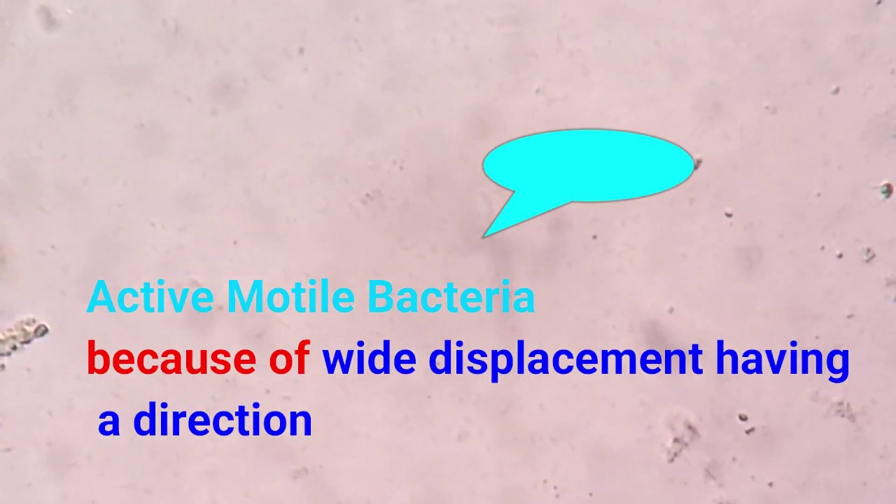 Hanging Drop preparation Positive/ darting motility positive/Vibrio ...