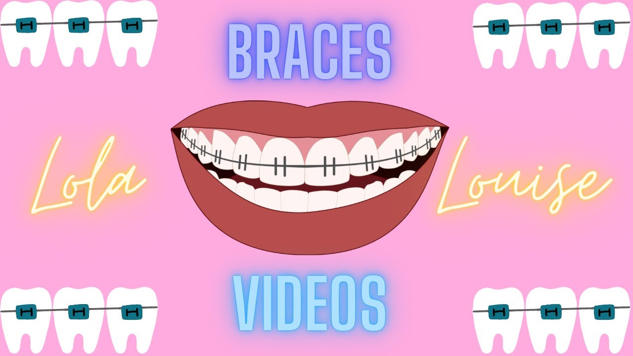 23 month of braces. Taking forever!!! (RE-UPLOAD) - YouTube