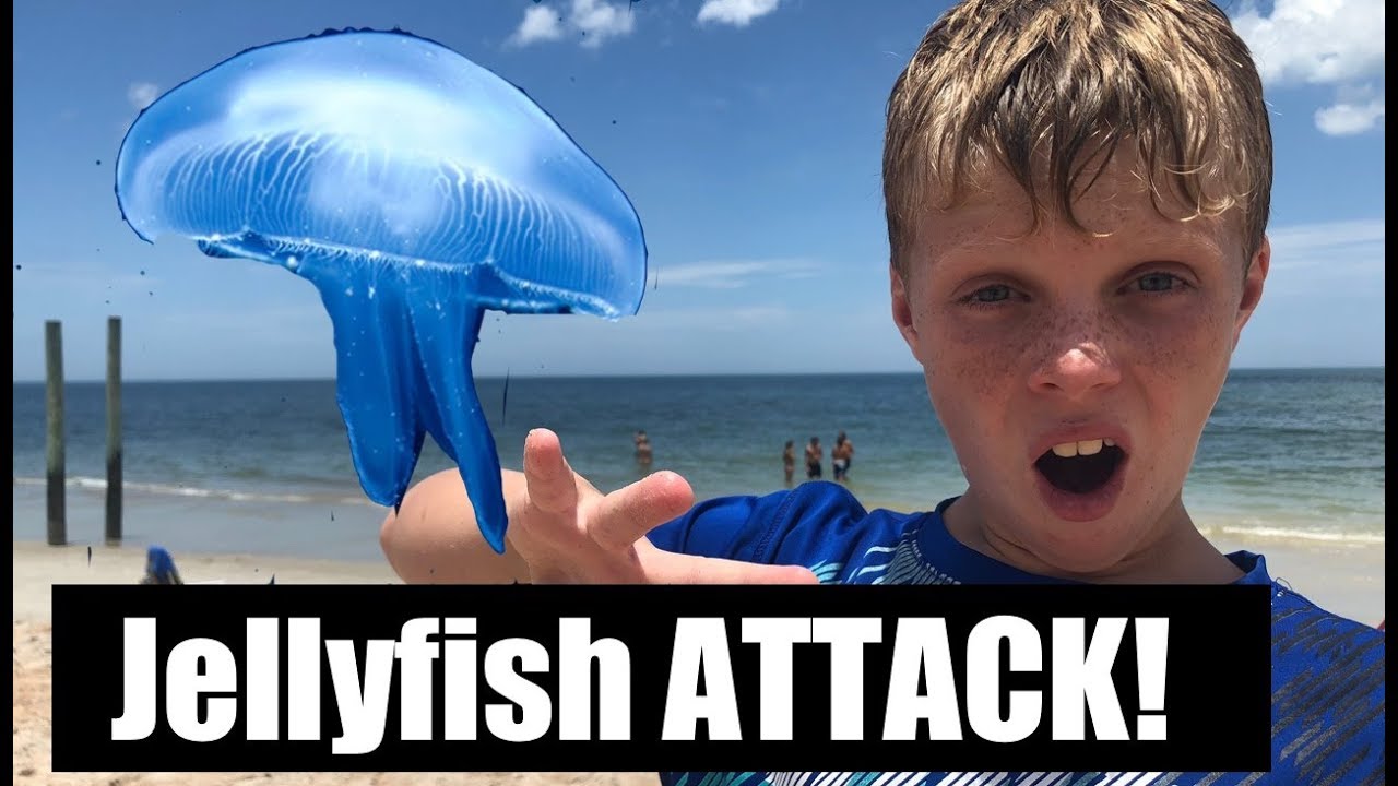 What to Do When You are Stung by a JELLYFISH! - YouTube
