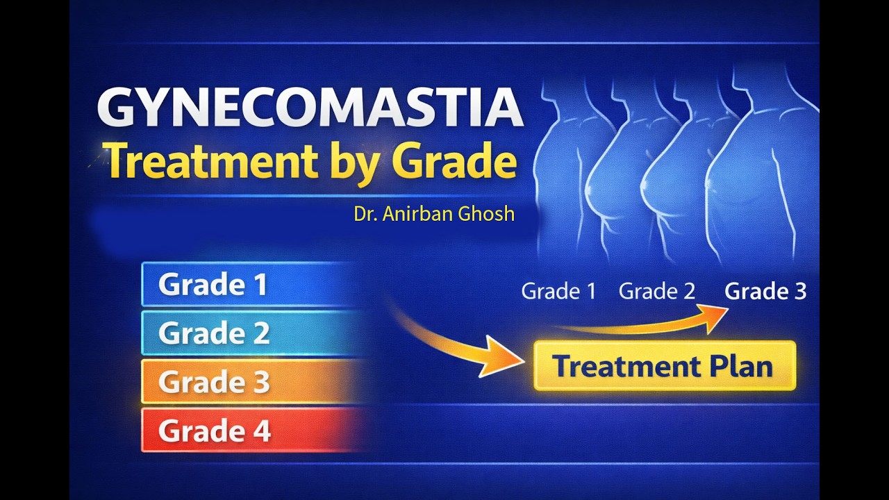 Gynecomastia Treatment by Grade | Grade 1, 2, 3, 4 Surgery Explained ...