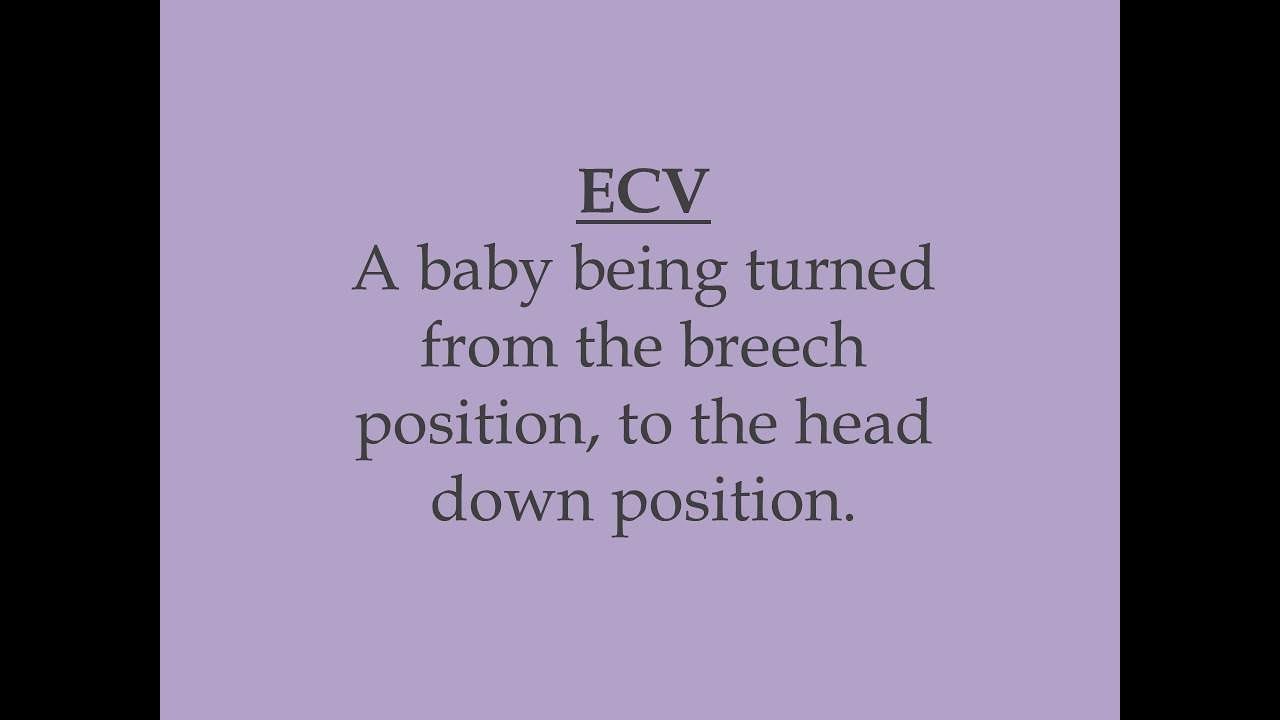 ECV - External Cephalic Version - YouTube