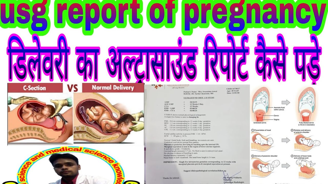 report of pregnancy in hindi explain डिलेवरी का अल्ट्रासाउंड रिपोर्ट ...