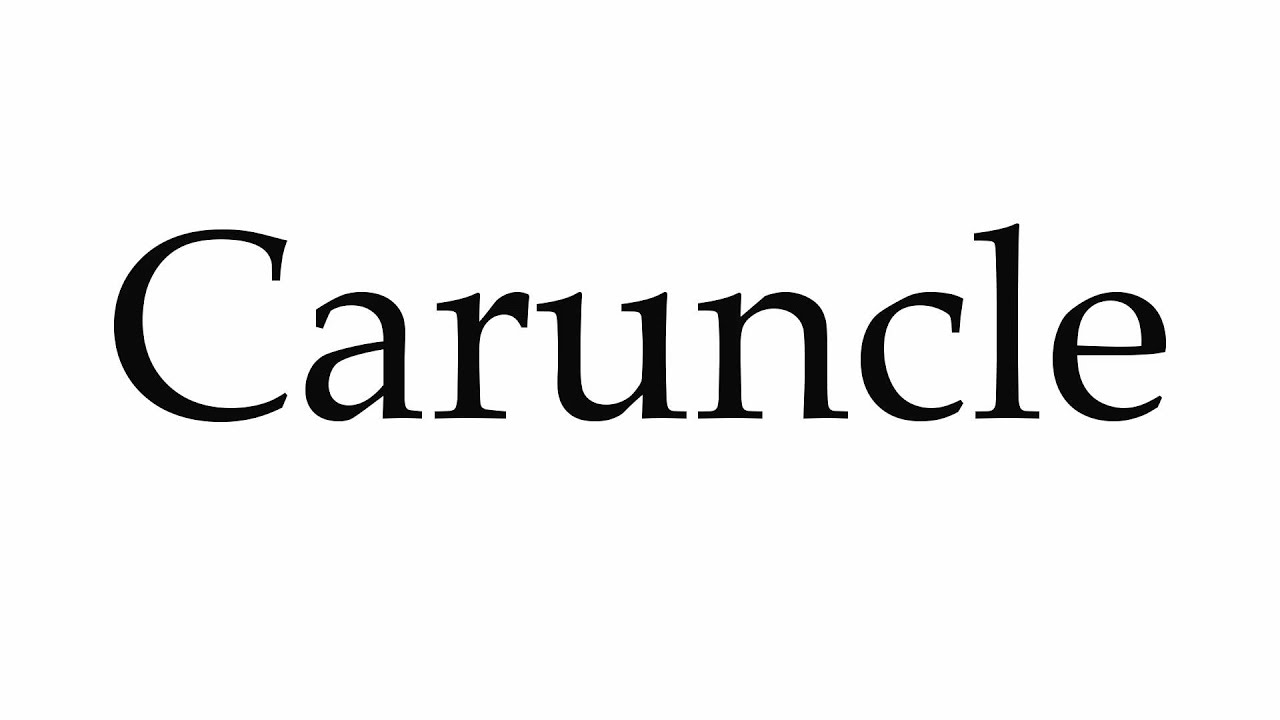 How to Pronounce Caruncle - YouTube