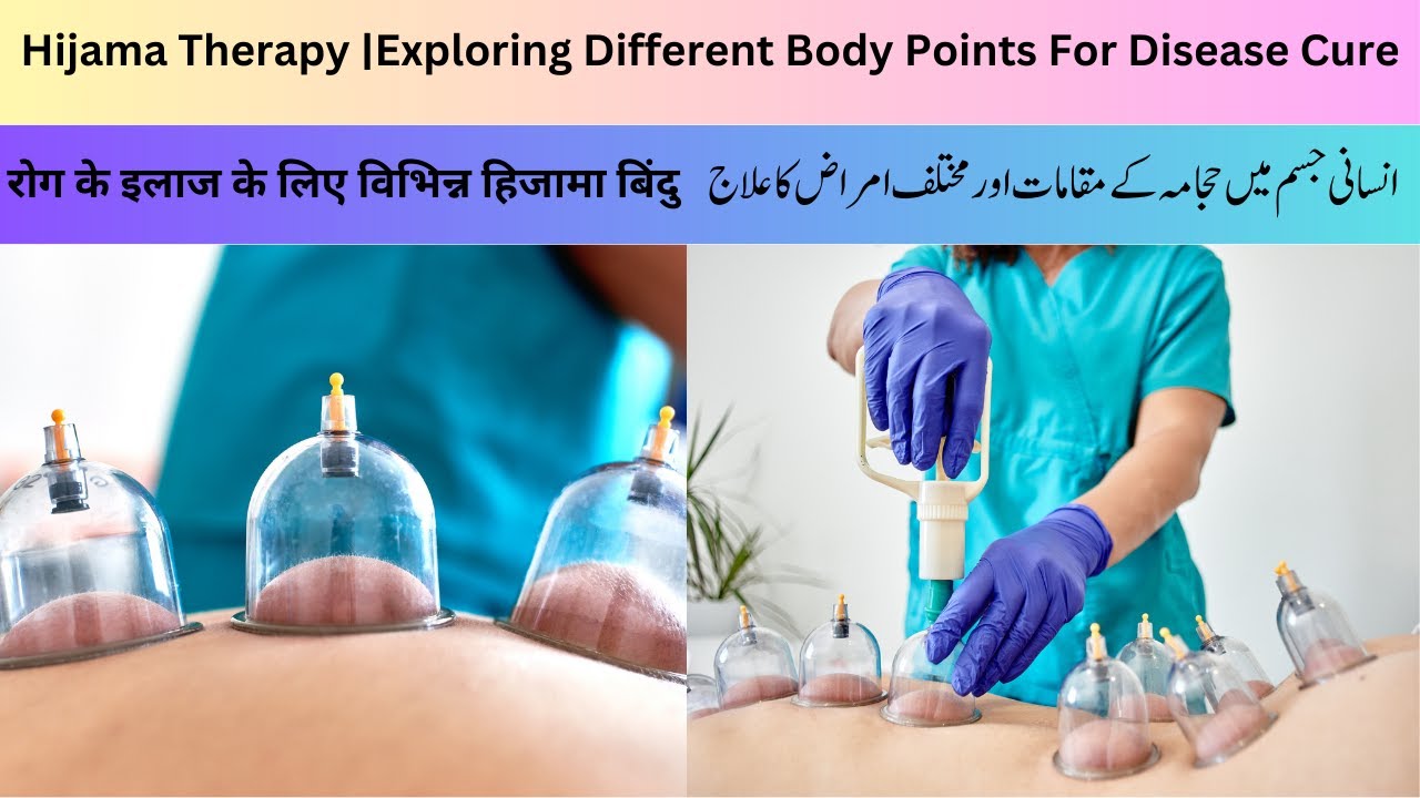 Hijama Therapy| Exploring Different Body Points for Disease Cure|حجامہ ...