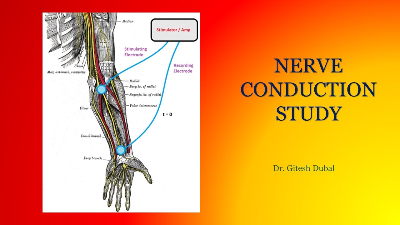 Nerve Conduction Velocity (NCV) - YouTube