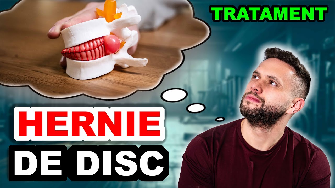 TRATAMENT HERNIE DE DISC EXPLICAT ! FARA INTERVENTIE CHIRUGICALA ...