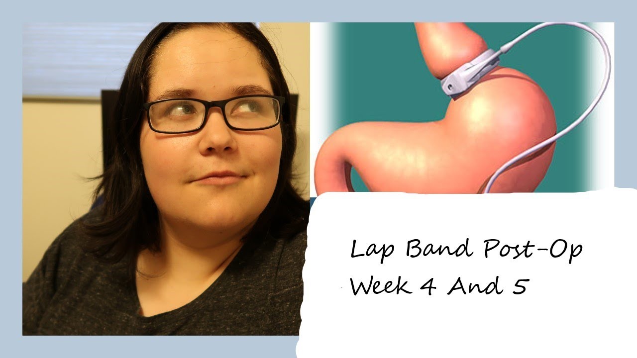 Lap Band Post-Op week 4 and 5 - YouTube