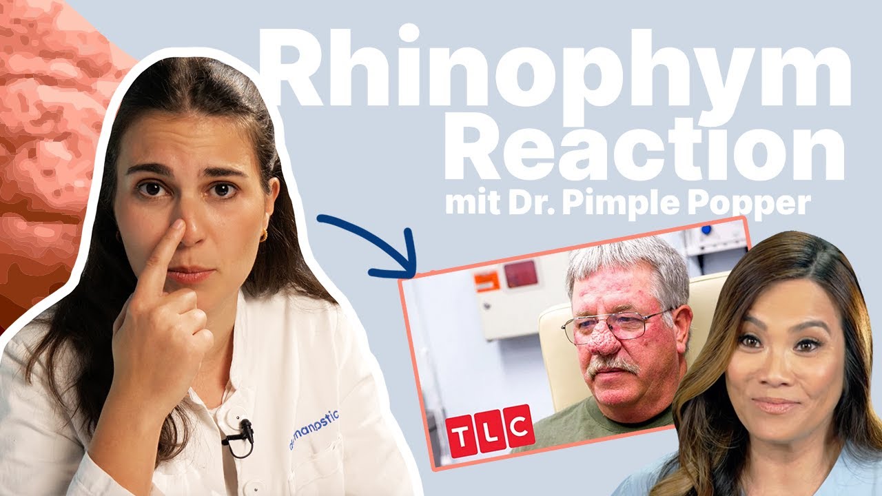 Ärztin reagiert: Rhinophym mit Dr. Pimple Popper - schlimmstes Stadium ...