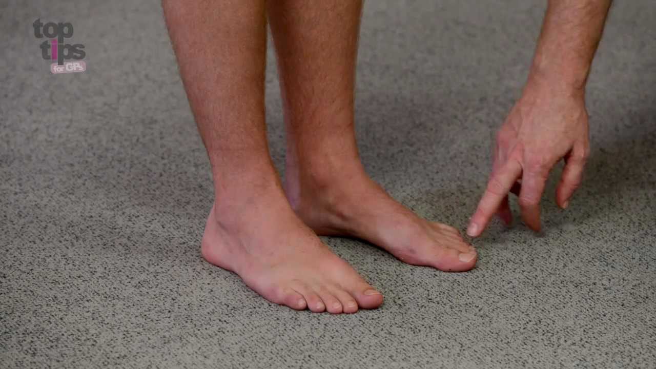 Orthopaedics Video 3 - examination of the foot & ankle - YouTube