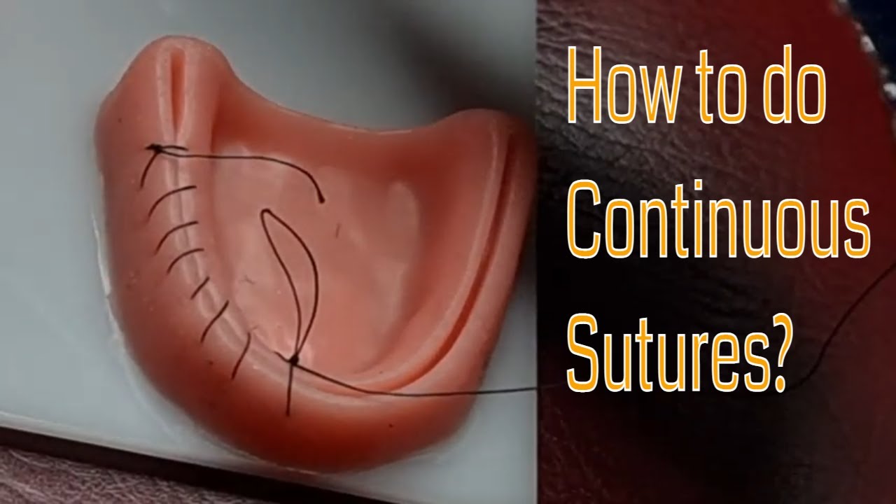Mastering Continuous Suturing Technique: A Step-by-Step Guide #sutures ...