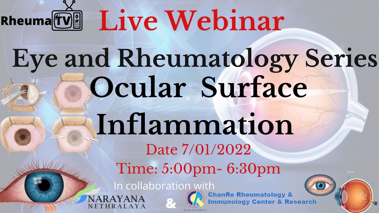 Eye and Rheumatology Series : Ocular Surface Inflammation - YouTube