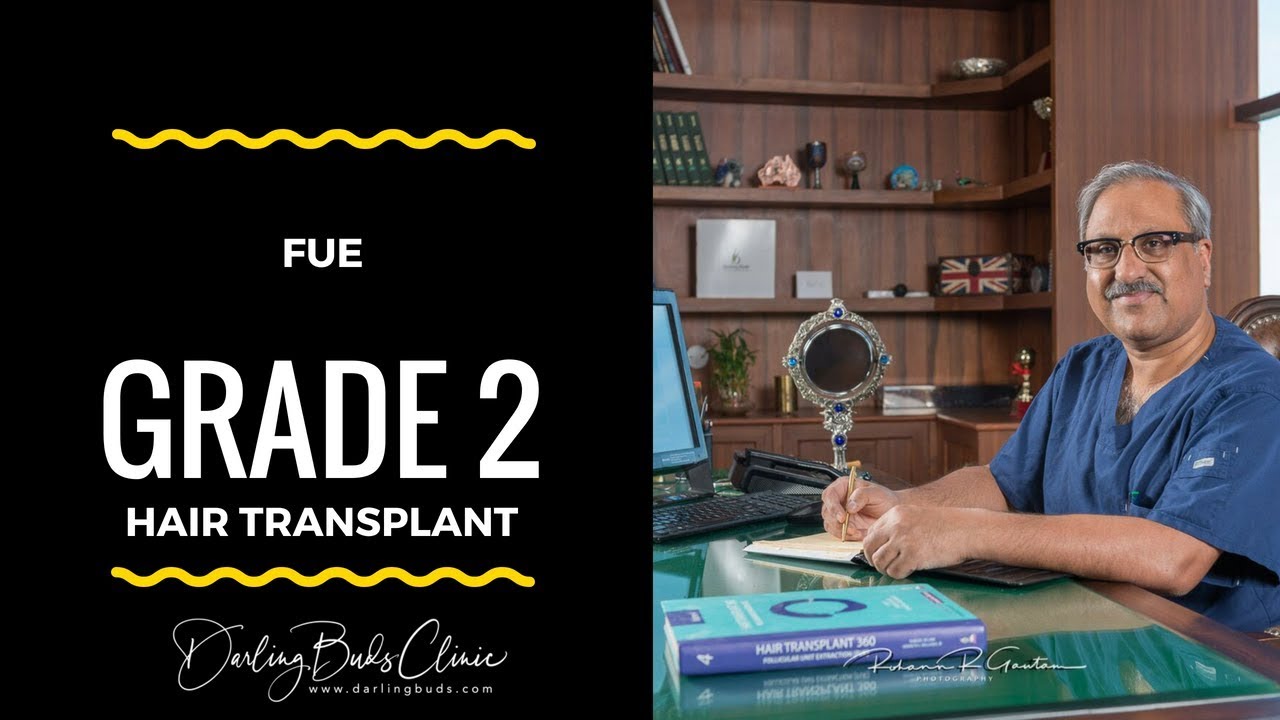 HAIRLINE UNDER STRONG LIGHT Hair Transplant for Grade 2 Baldness - YouTube