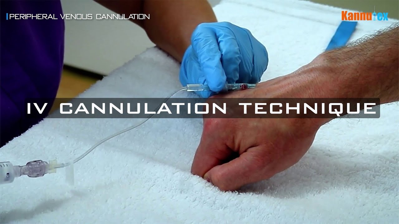 Tips and tricks for IV cannulation - YouTube