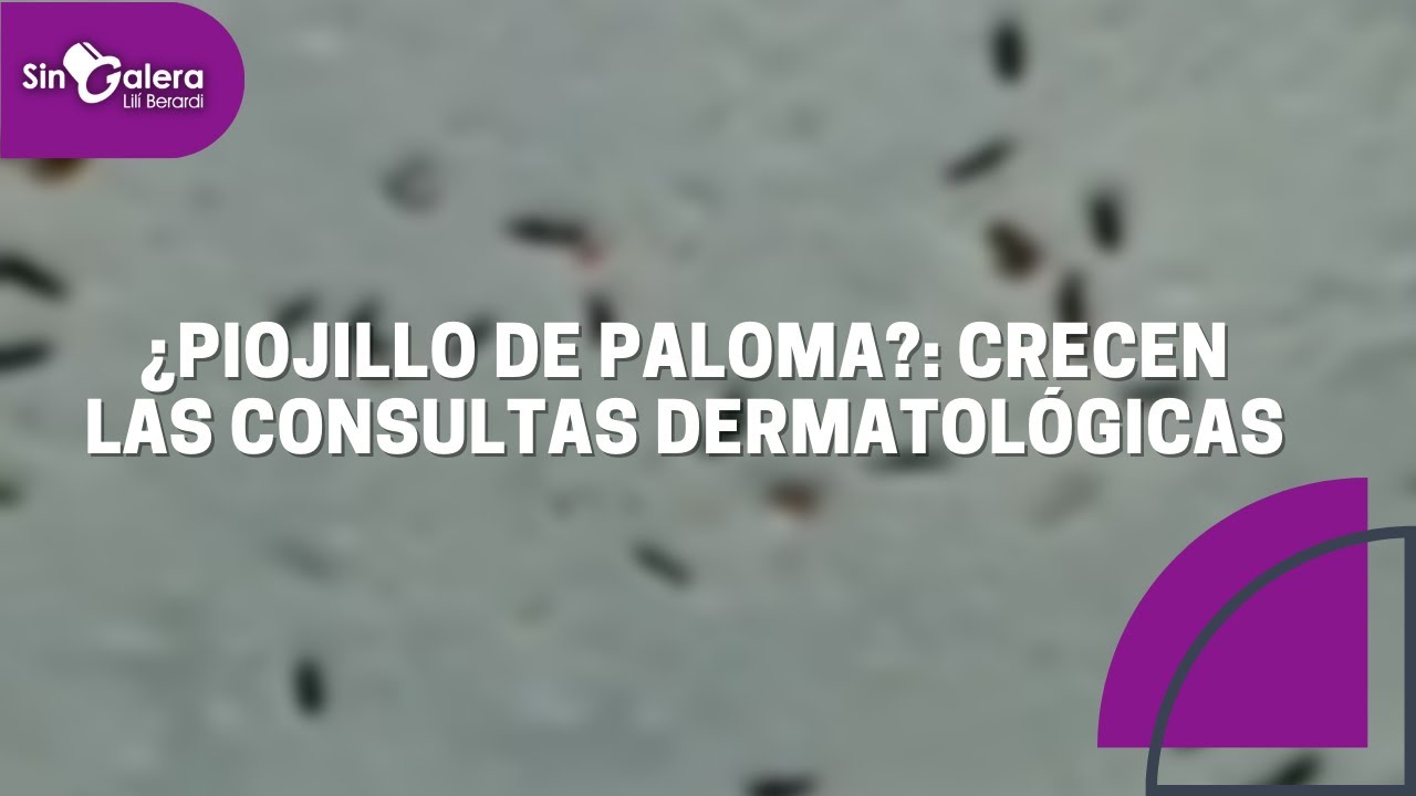 ¿Piojillo de paloma?: crecen las consultas dermatológicas - YouTube