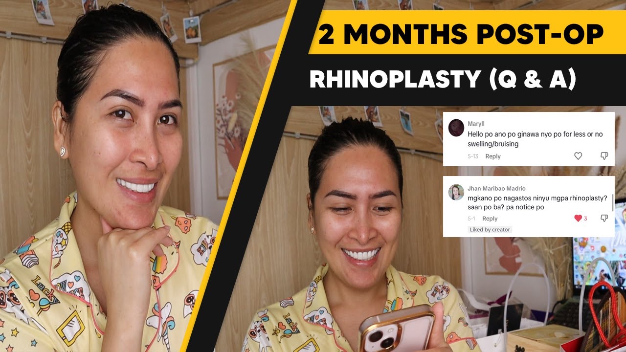 My 2-Month Post-Op Rhinoplasty Journey + Q&A | Day See - YouTube