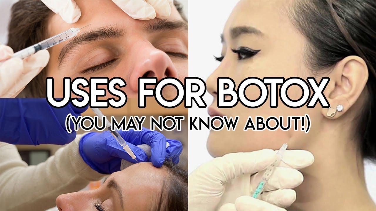 Non-Cosmetic Uses for Botox - YouTube