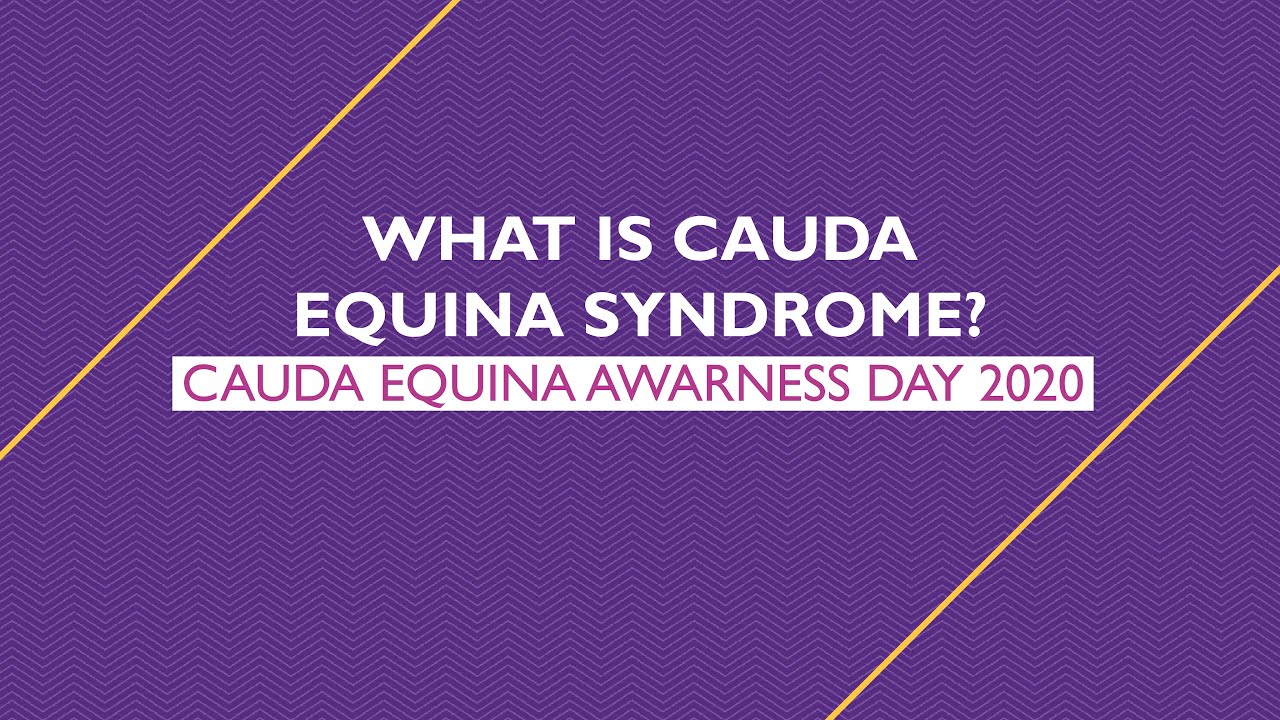 Cauda Equina Awareness Day 2020 | What is Cauda Equina Syndrome? - YouTube