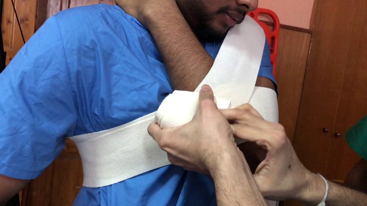 Velpeau's bandage (Desmurgy) - YouTube