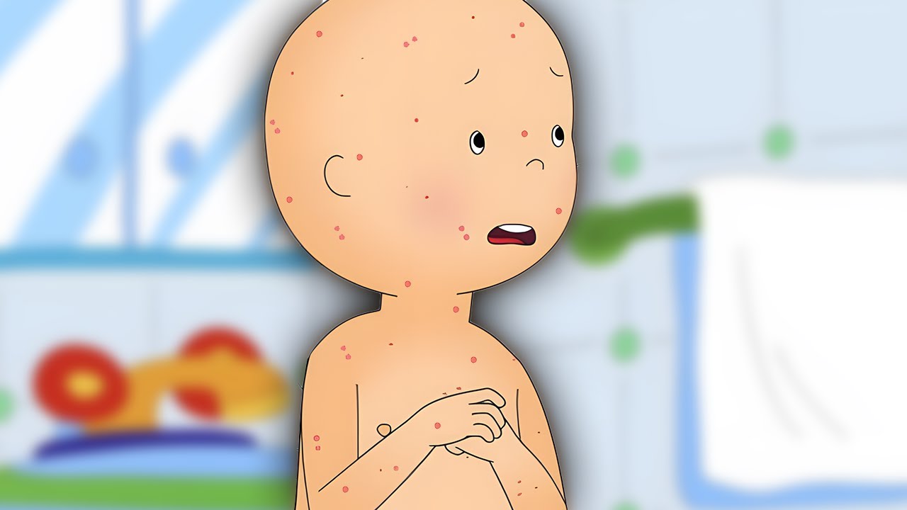 Miten käsitellä vesirokko | Caillou em Português - WildBrain - YouTube