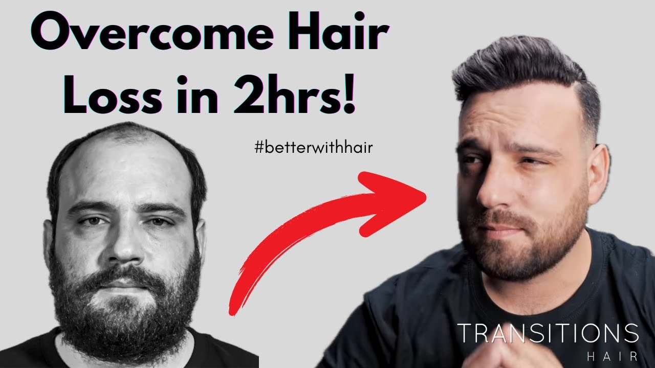 Watch this Incredible Hair Transformation! Thick Full Hair in 2 hrs ...