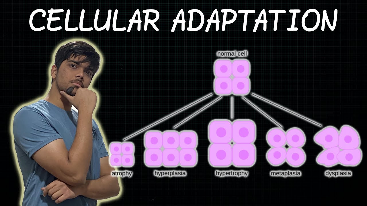 G. Pathology - Cellular Adaptation (Atrophy, Hypertrophy, Hyperplasia ...