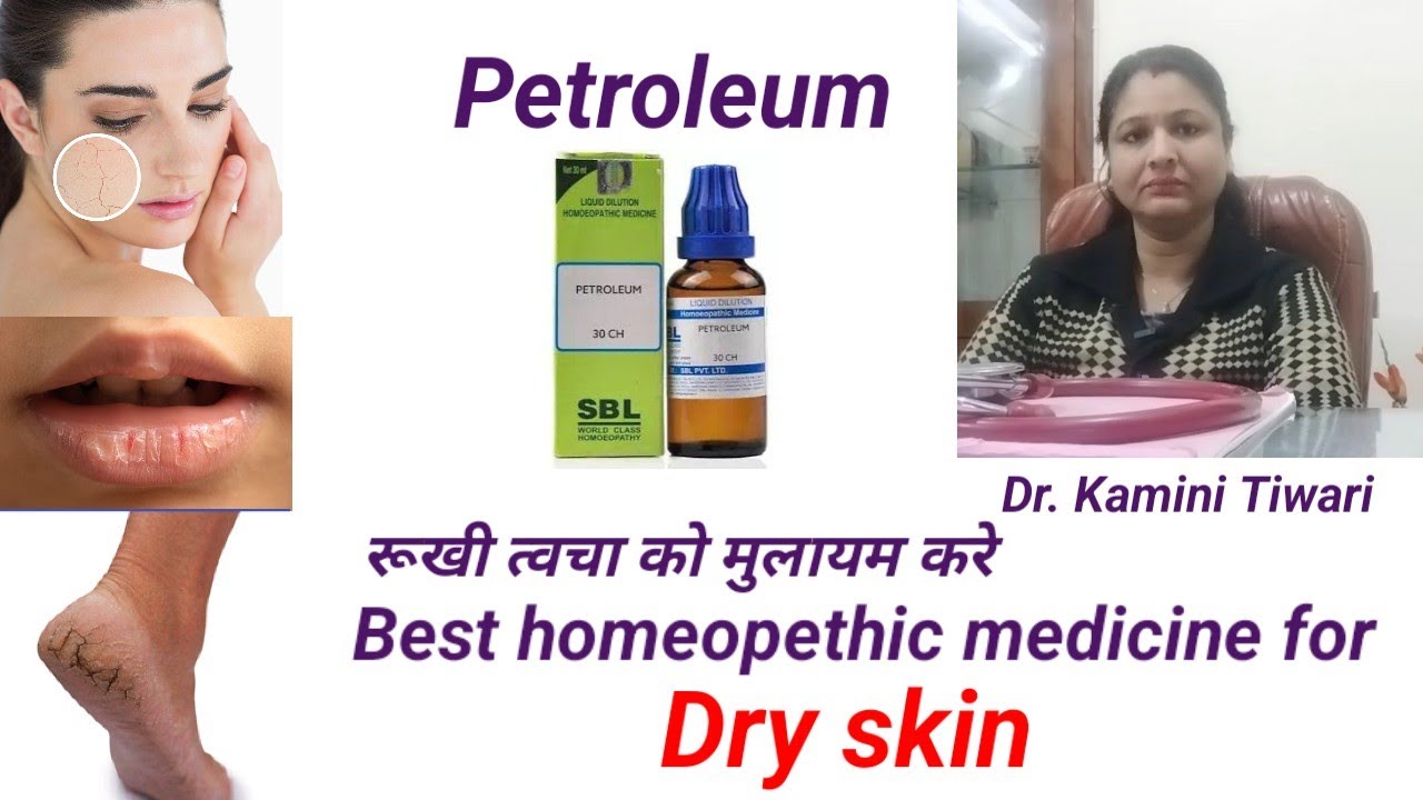 Dry skin || Petroleum 30c petroleum 200c || रूखी त्वचा को मुलायम बनाने ...
